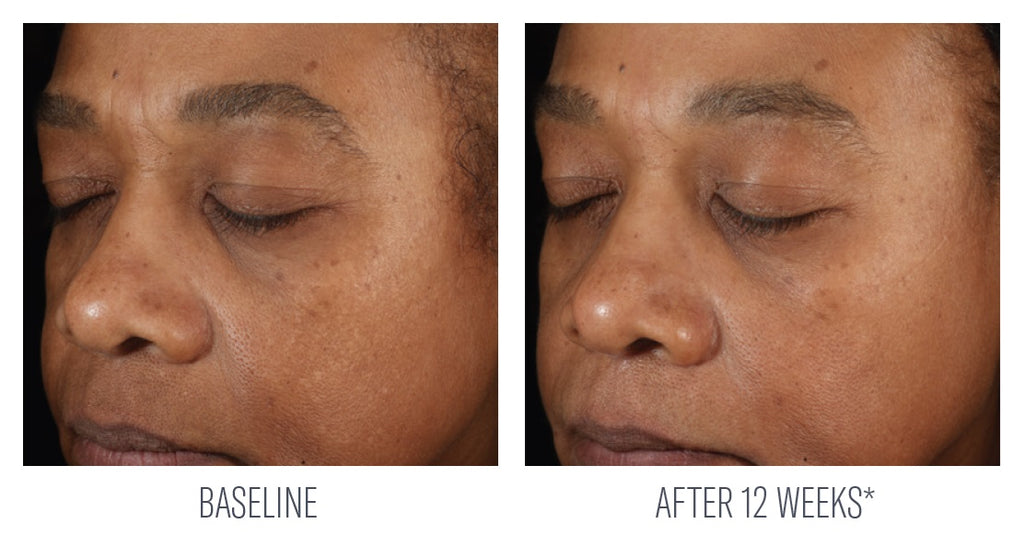 A-Team Duo Advanced Kit – AestheticSource