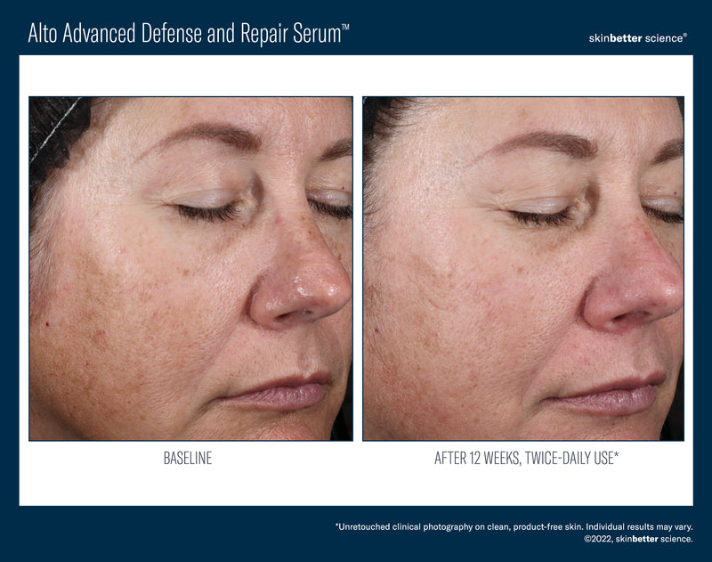 Alto Advanced Defense and Repair Serum™ – AestheticSource