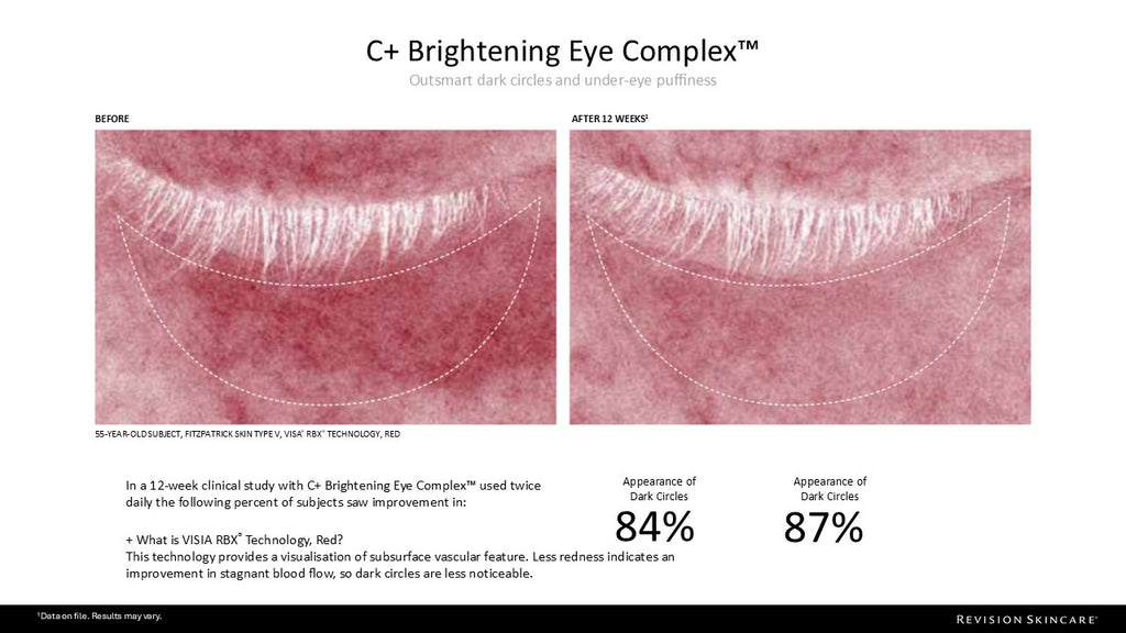 C+ Brightening Eye Complex™ – AestheticSource