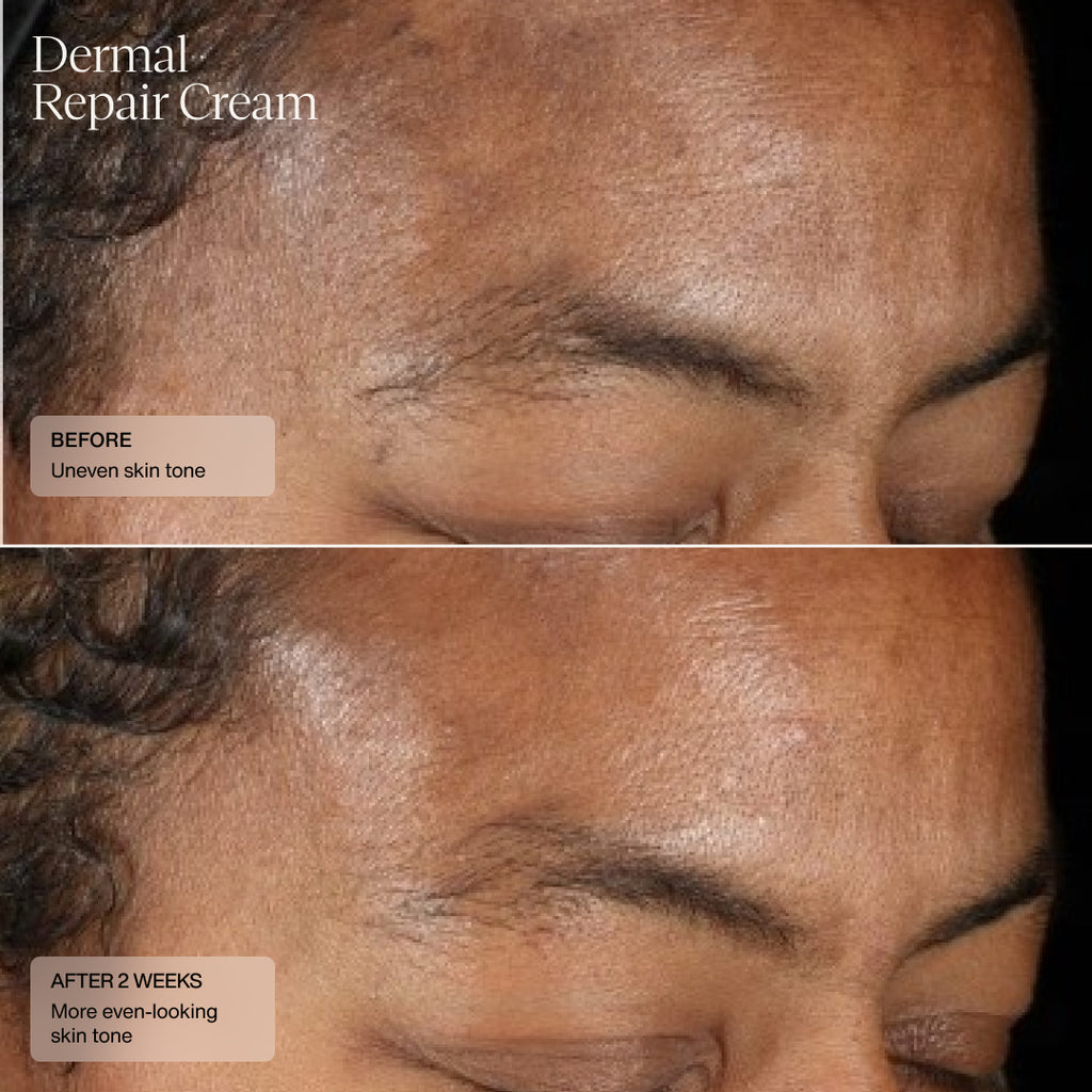 Senté Dermal Repair Cream – AestheticSource