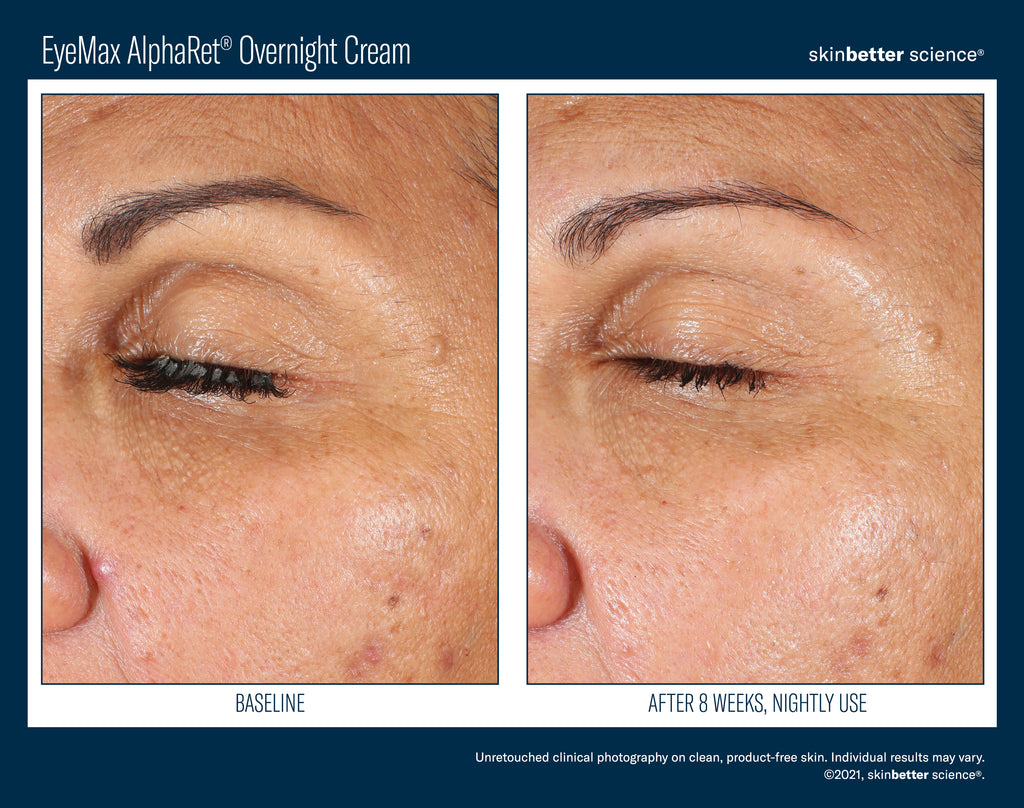 EyeMax™ AlphaRet® Overnight Cream – AestheticSource