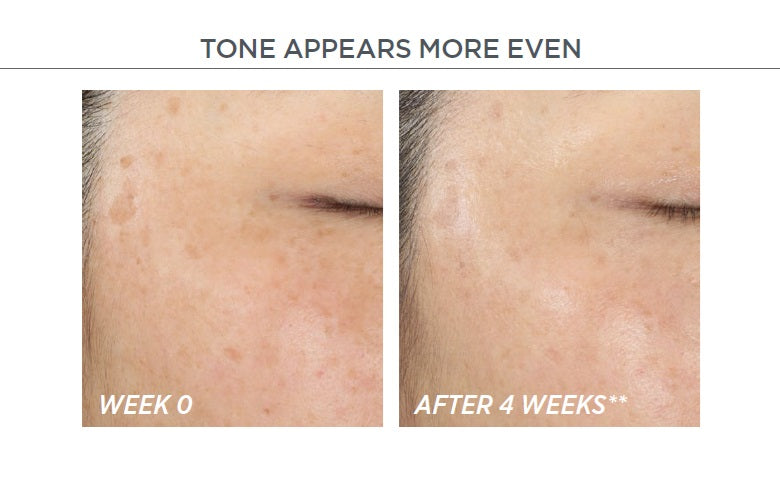 NEOSTRATA® Restore PHA Renewal Pads – AestheticSource